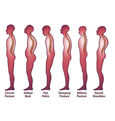 Diagram of a human spine in front and side Vector Image
