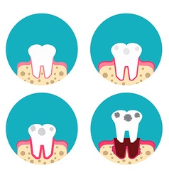 Periodontal Disease Vector Images (over 540)