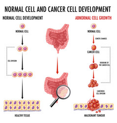 Diagram showing normal and cancer cell Royalty Free Vector