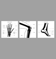 Obese skeleton anatomy Royalty Free Vector Image