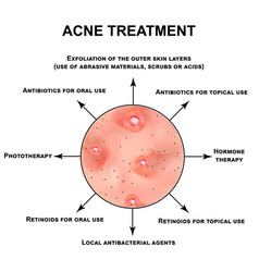 Acne treatment pustules papules comedones Vector Image