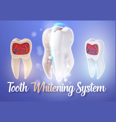 Whitening toothpaste ad realistic Royalty Free Vector Image