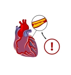 The risk of heart failure Royalty Free Vector Image