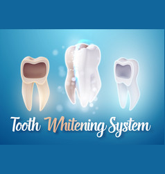 Whitening toothpaste ad realistic Royalty Free Vector Image
