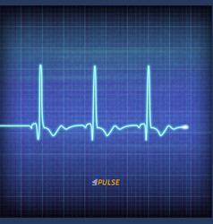Ecg of st elevation myocardial infarction stemi Vector Image